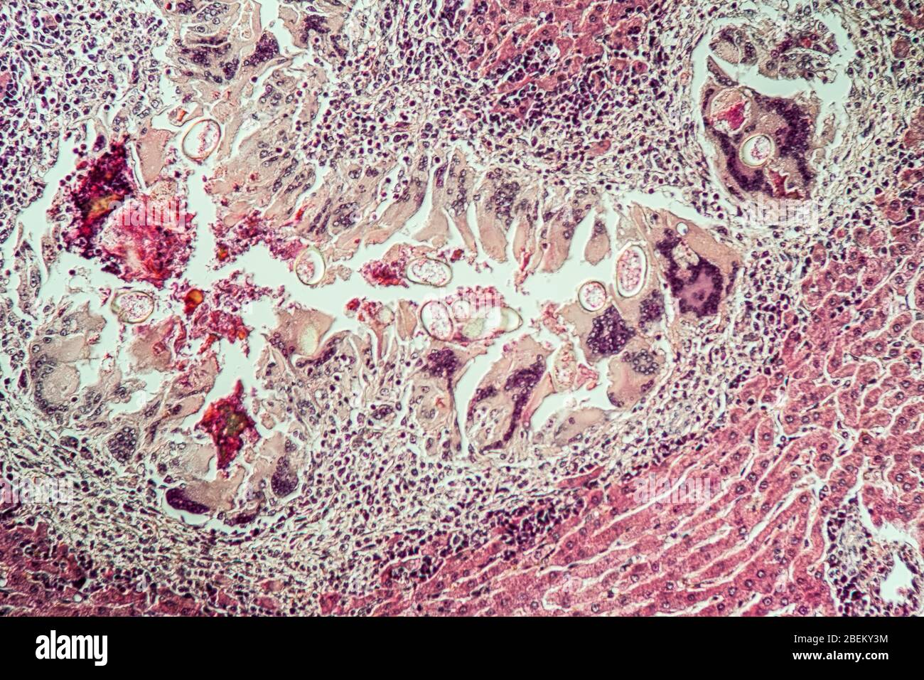 œufs de parasites Banque de photographies et d’images à haute ...