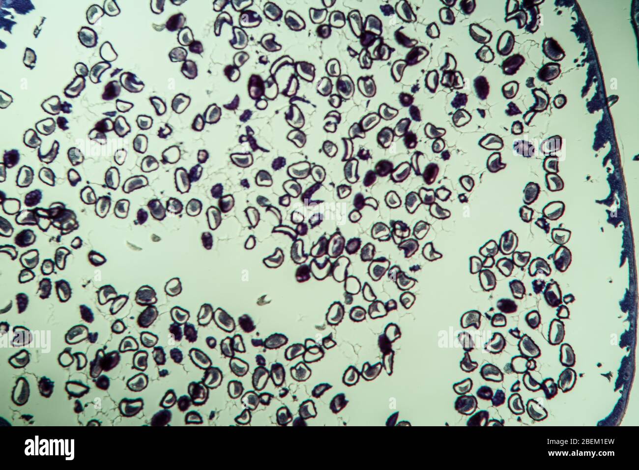 Coupe transversale d'ascaris Banque de photographies et d’images à ...