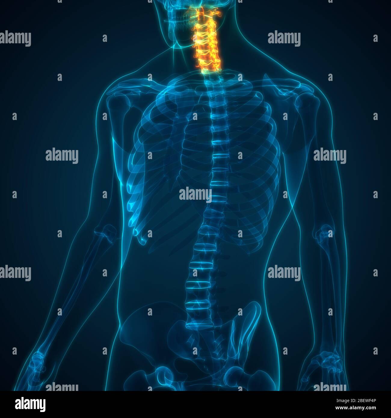 La colonne vertébrale cervicale du squelette humain Anatomie du système ...