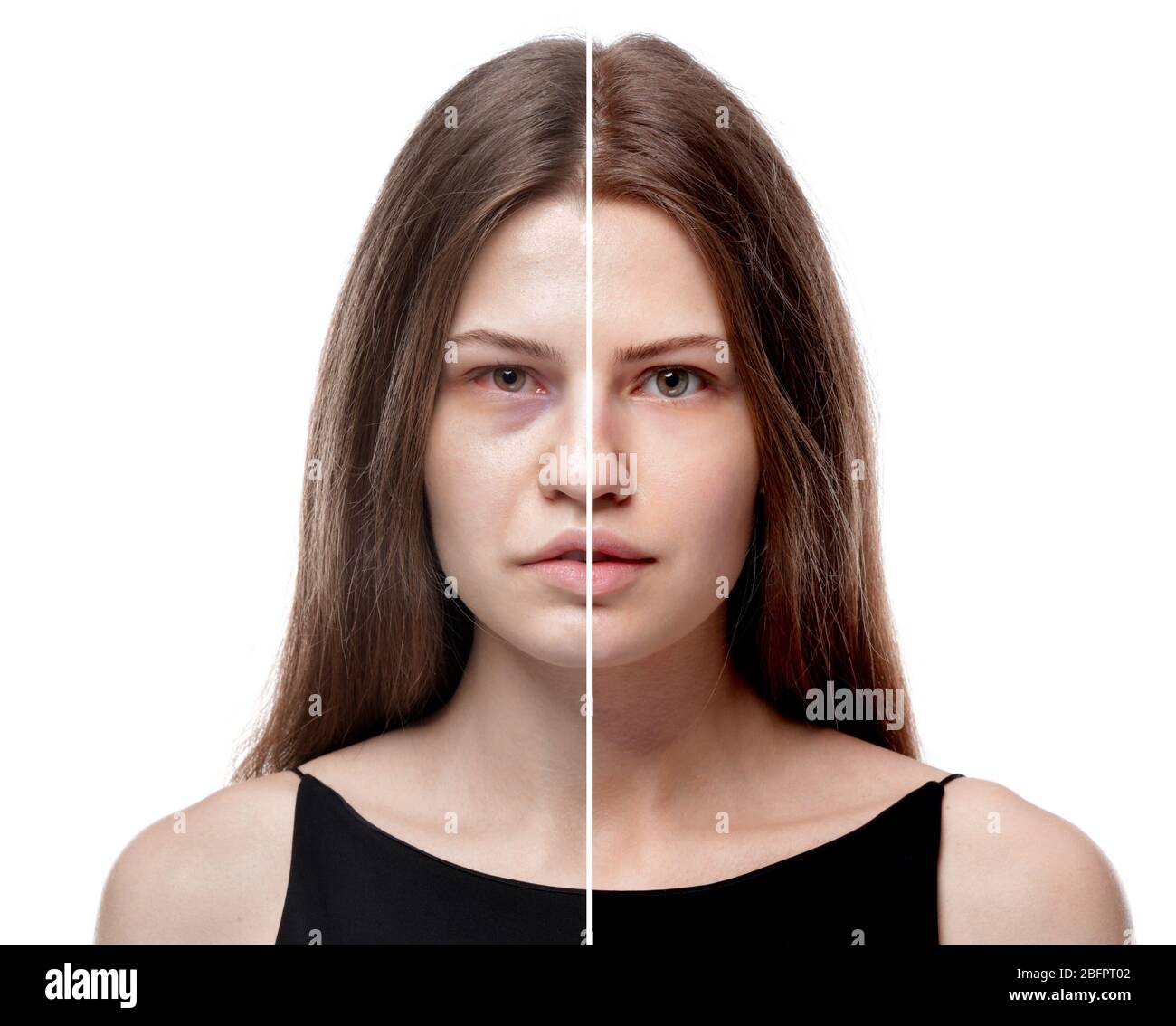 La privation de sommeil Banque de photographies et d’images à haute ...