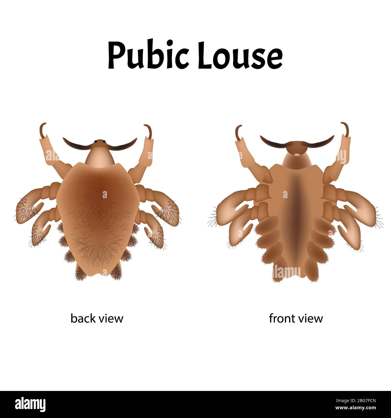 Pou de corps humain Banque d'images vectorielles - Alamy