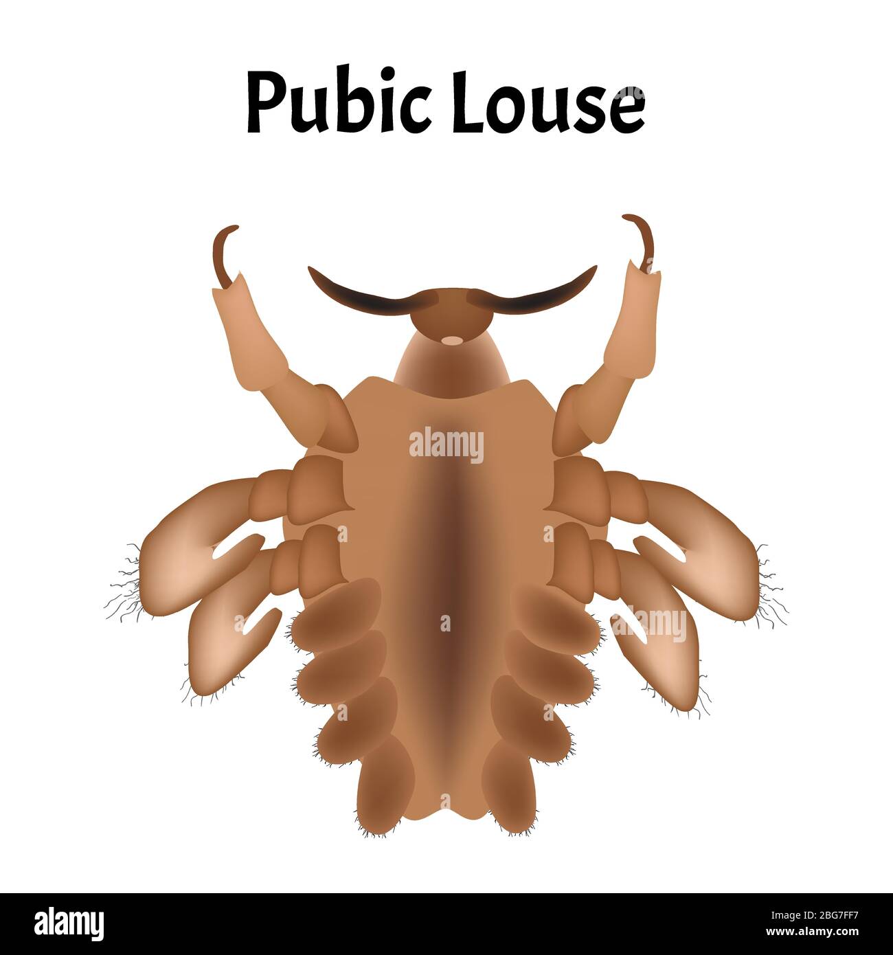Maladies parasitaires de la phthiriase. Pubis de pédiculose. Structure ...
