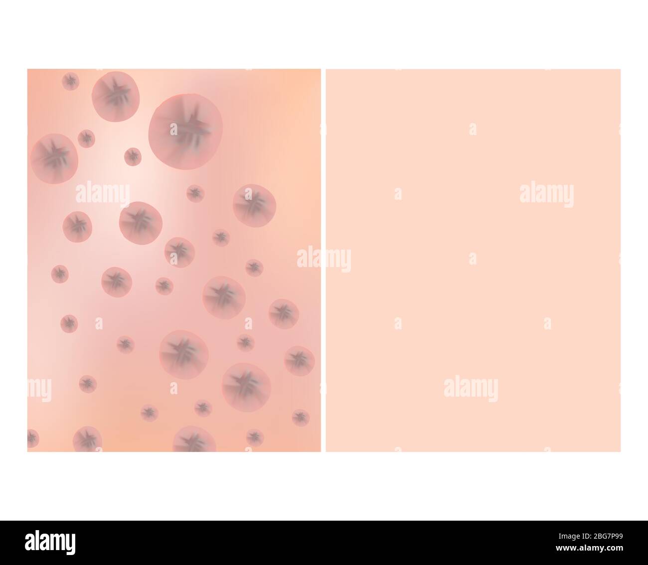 Texture avec cicatrices d'acné et acné. Avant après les kystes de ...