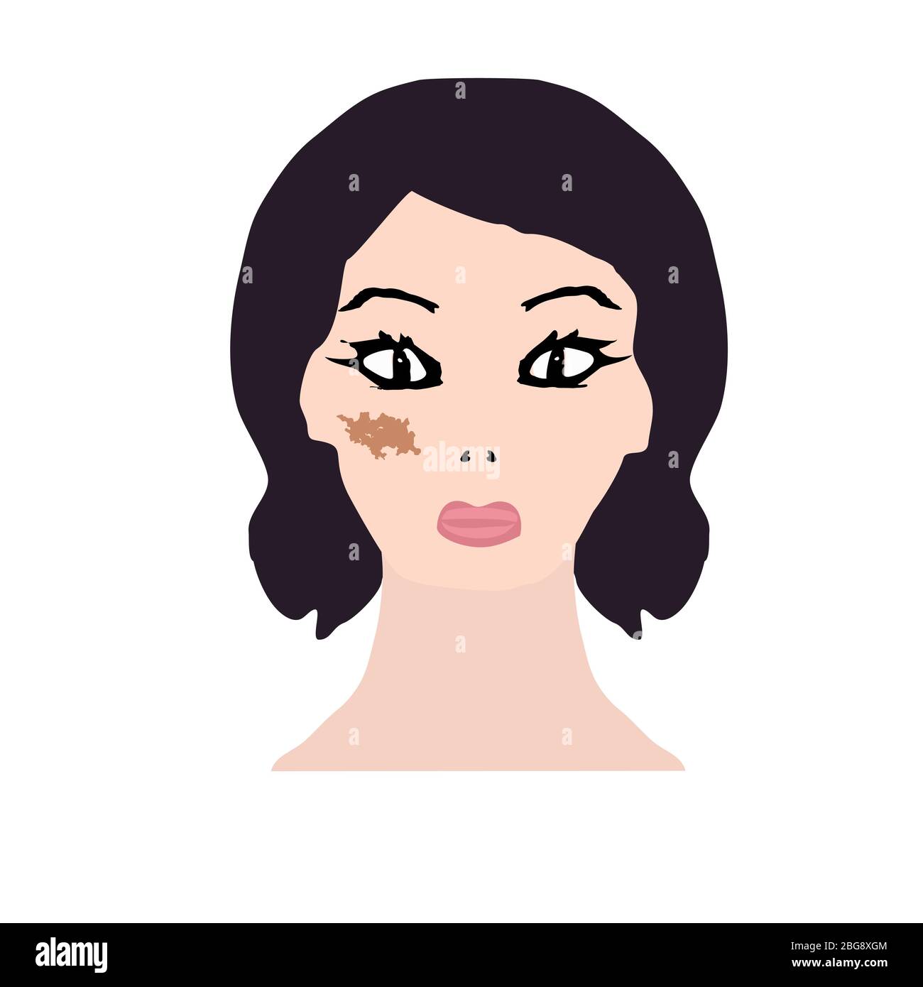 Taches brunes peau humaine Banque d'images vectorielles - Alamy