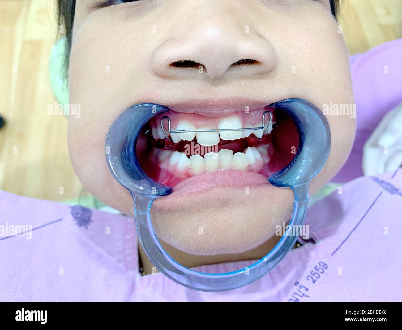 Gag mouth Banque de photographies et d’images à haute résolution - Alamy