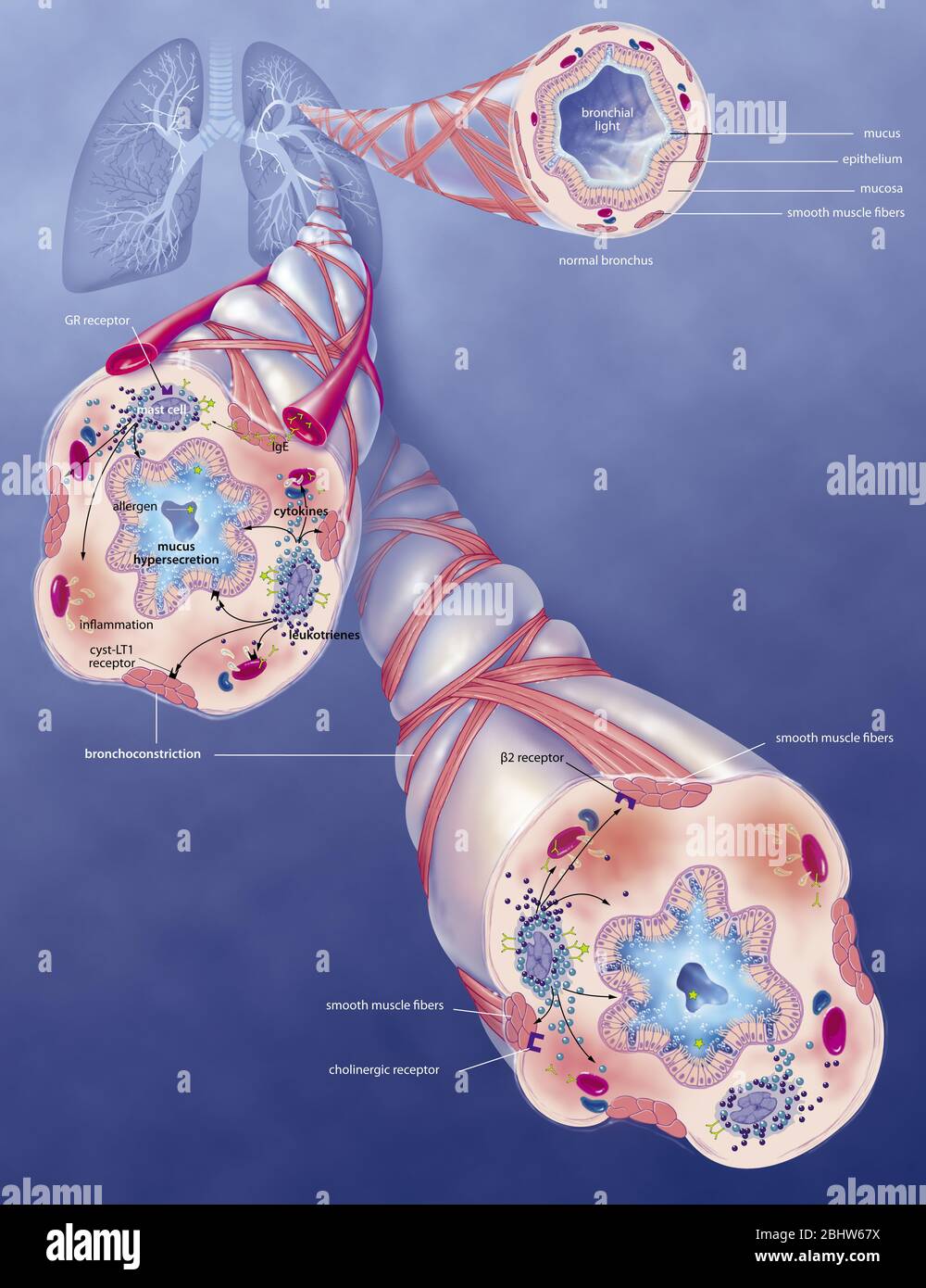 Bronchial tree Banque de photographies et d’images à haute résolution ...