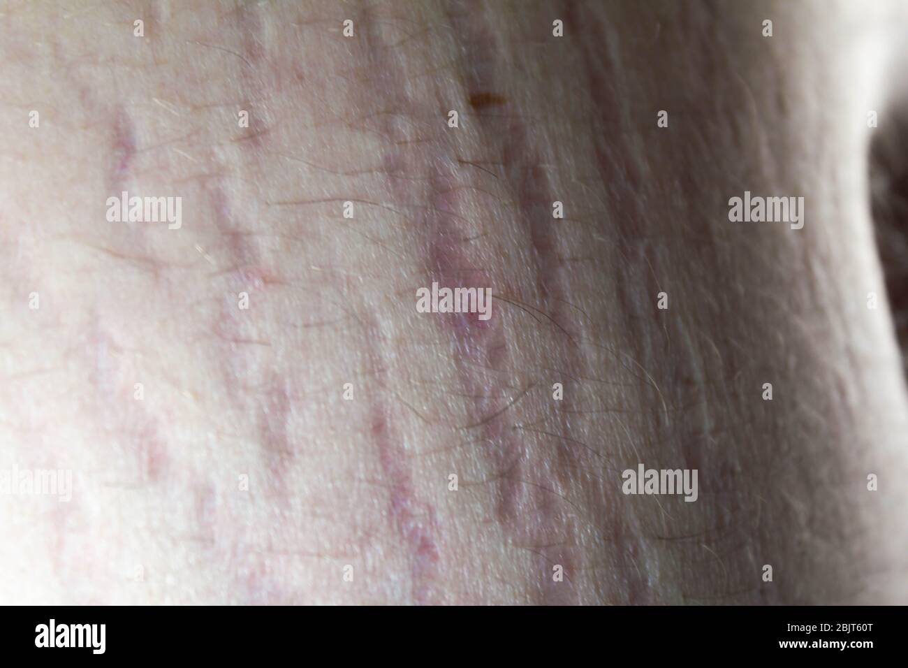 Belly button Banque de photographies et d’images à haute résolution - Alamy