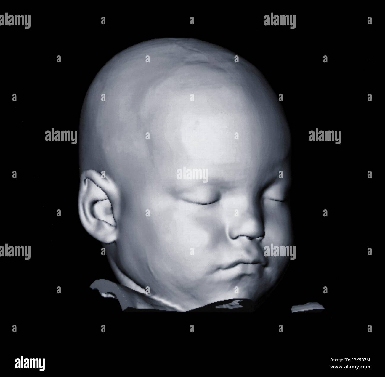 Ct scan head Banque de photographies et d’images à haute résolution - Alamy