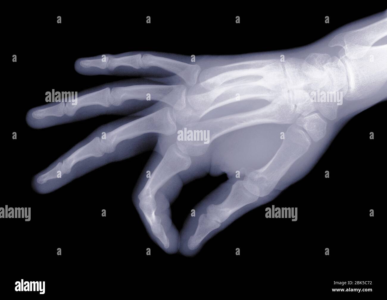 Hand x ray Banque de photographies et d’images à haute résolution - Alamy