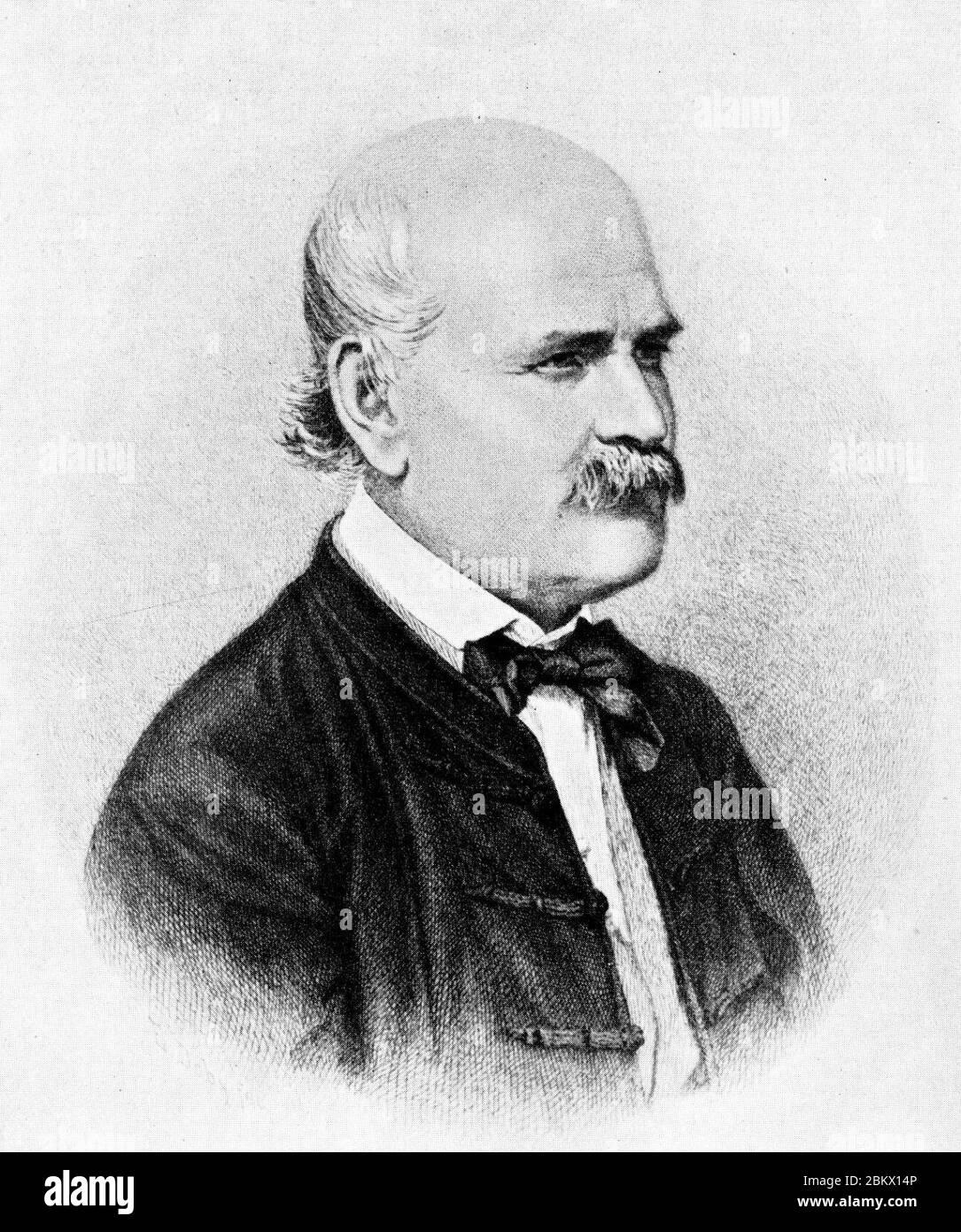 Ignaz semmelweis Banque de photographies et d’images à haute résolution ...