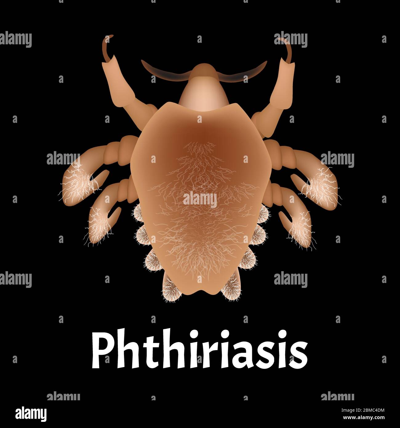Maladies parasitaires de la phthiriase. Pubis de pédiculose. Structure ...