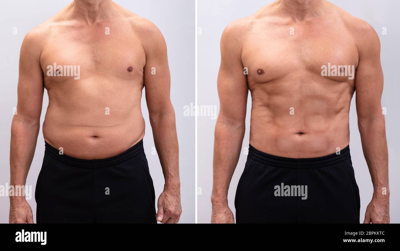 Homme avant et après perte de poids Banque de photographies et d’images ...