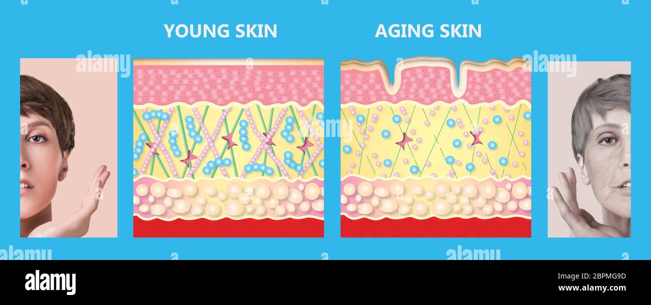 Le plus jeune peau et vieillissement de la peau. L'élastine et du collagène. Un diagramme de ...