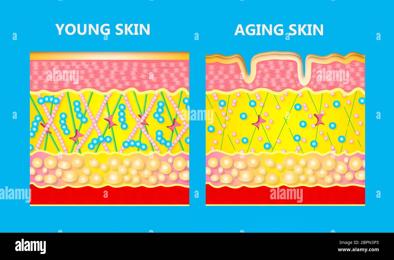 Le schéma d'une peau plus jeune et le vieillissement de la peau montrant la diminution de ...