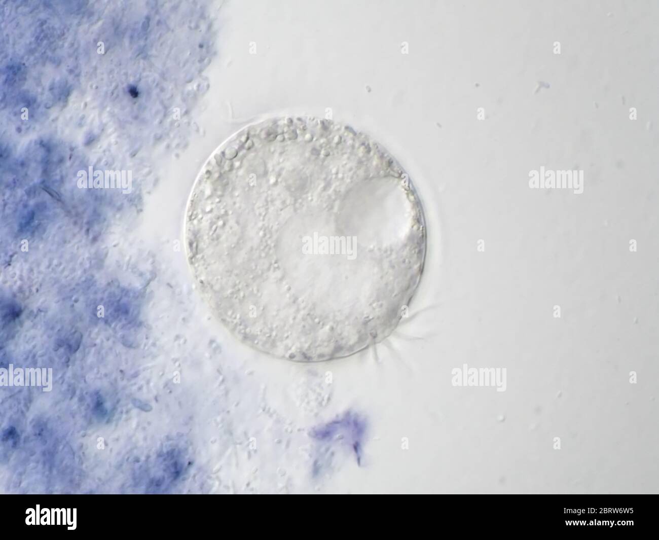 Un protozoaire cilié Banque de photographies et d’images à haute ...