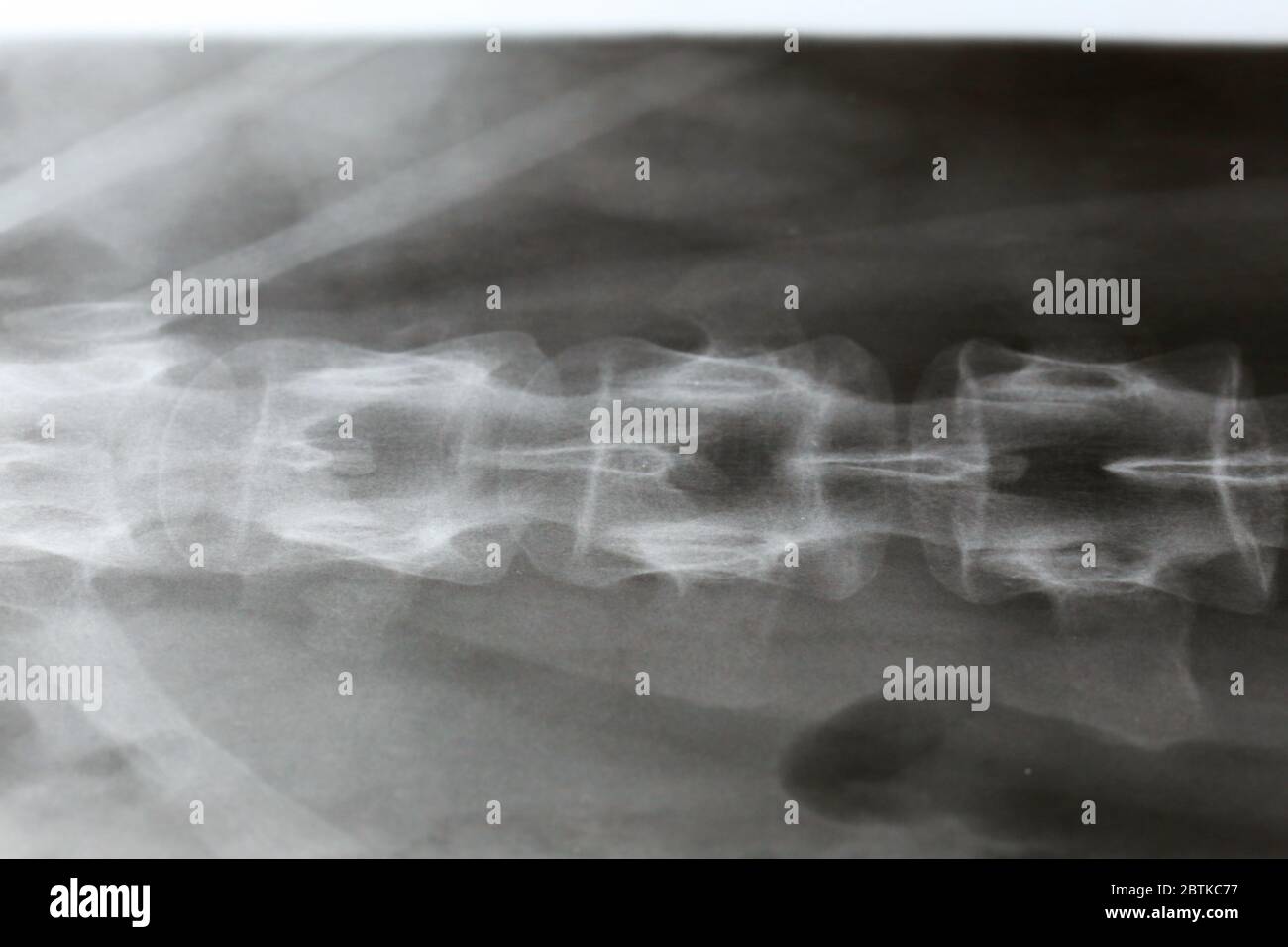 Image radiographique d'une moelle épinière Photo Stock - Alamy