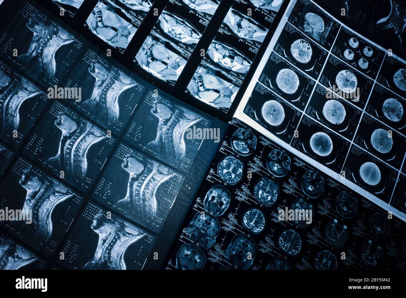 Ct cou Banque de photographies et d’images à haute résolution - Alamy