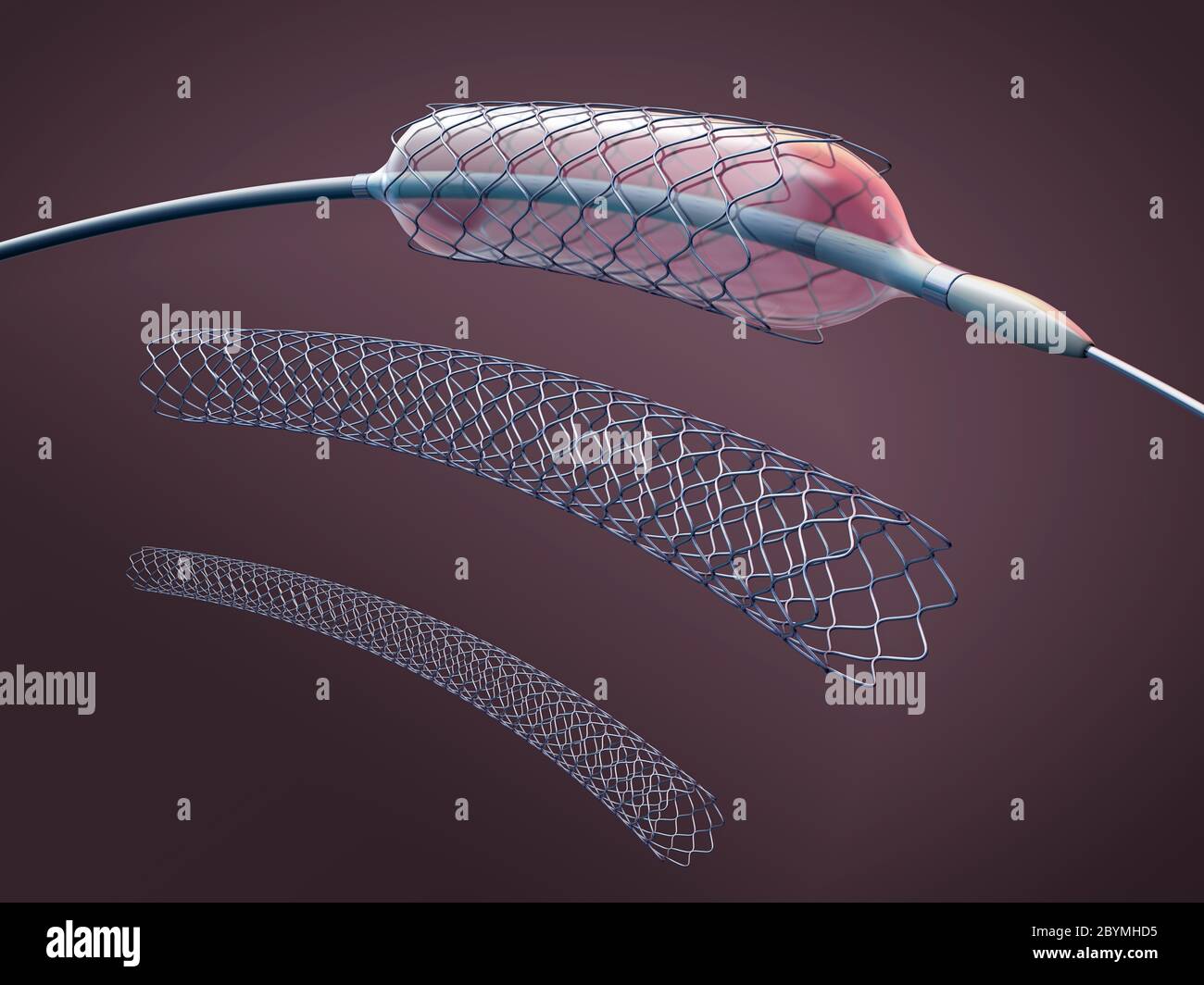 Trois stents métalliques pour l'implantation et le soutien de la ...