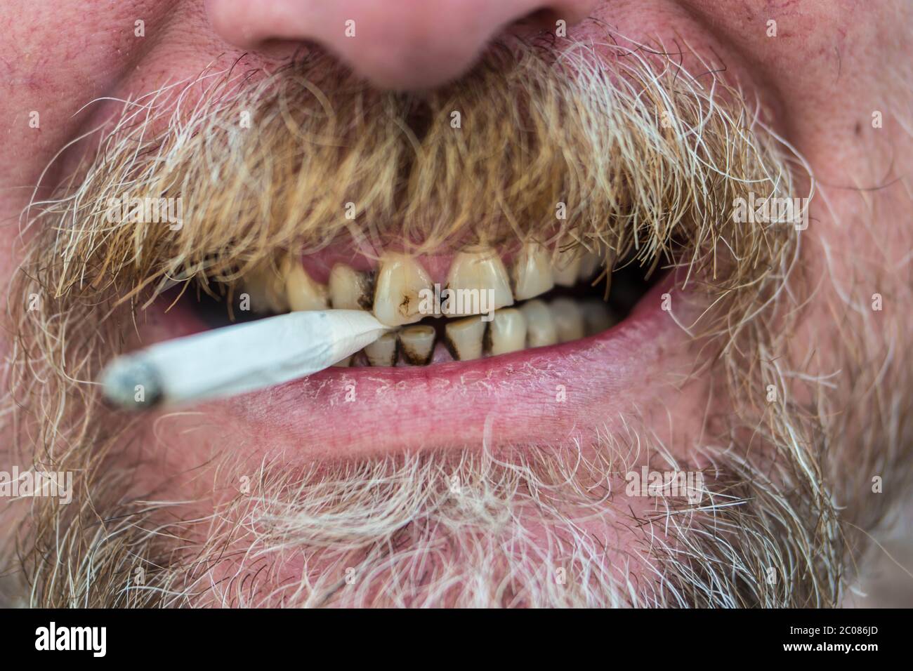 Smoking teeth Banque de photographies et d’images à haute résolution ...