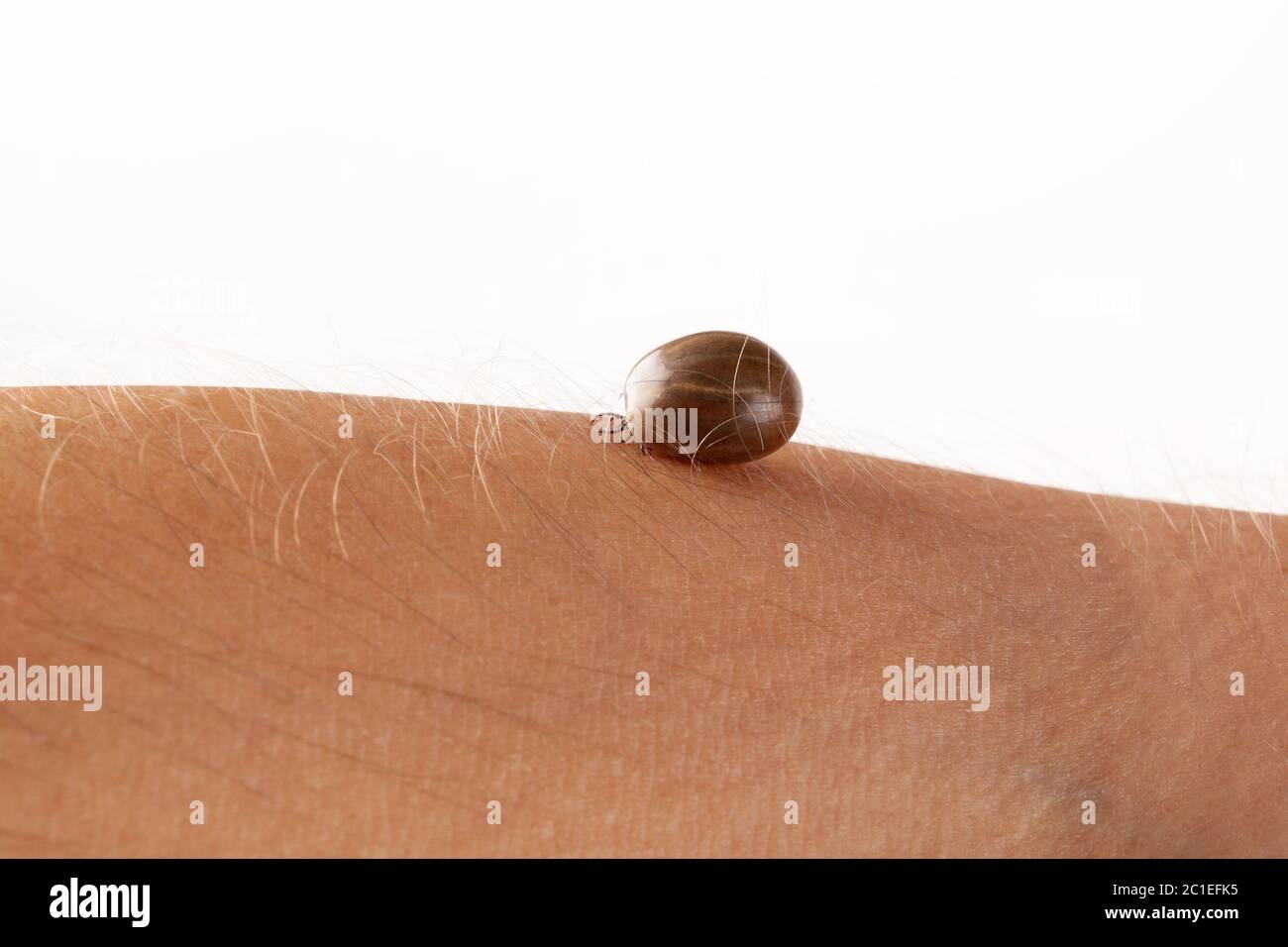 Morsure de tique Banque de photographies et d’images à haute résolution ...