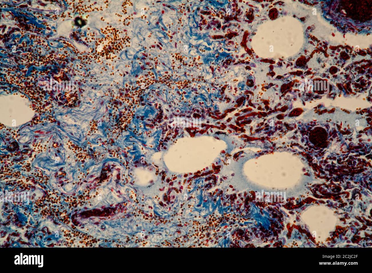 Le tissu pulmonaire Banque de photographies et d’images à haute ...