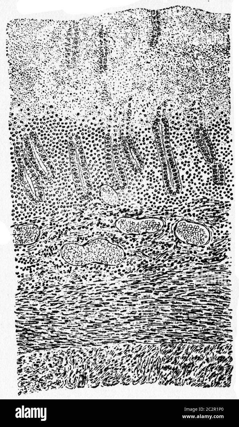 Musculeuse muqueuse Banque d'images noir et blanc - Alamy