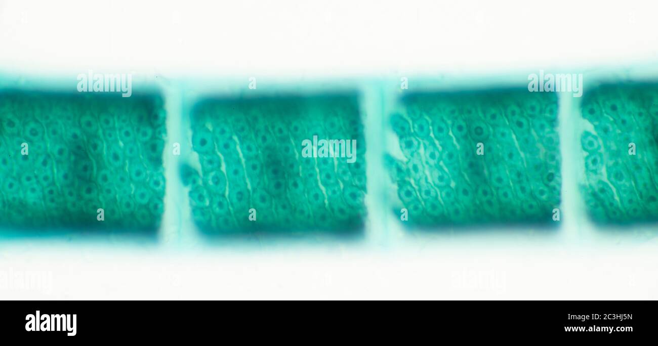 Algues vertes charophytes filamenteuses Banque de photographies et d ...