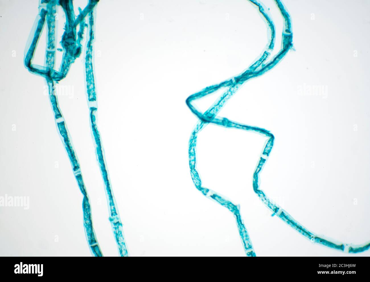 Microscopic view algae Banque de photographies et d’images à haute ...