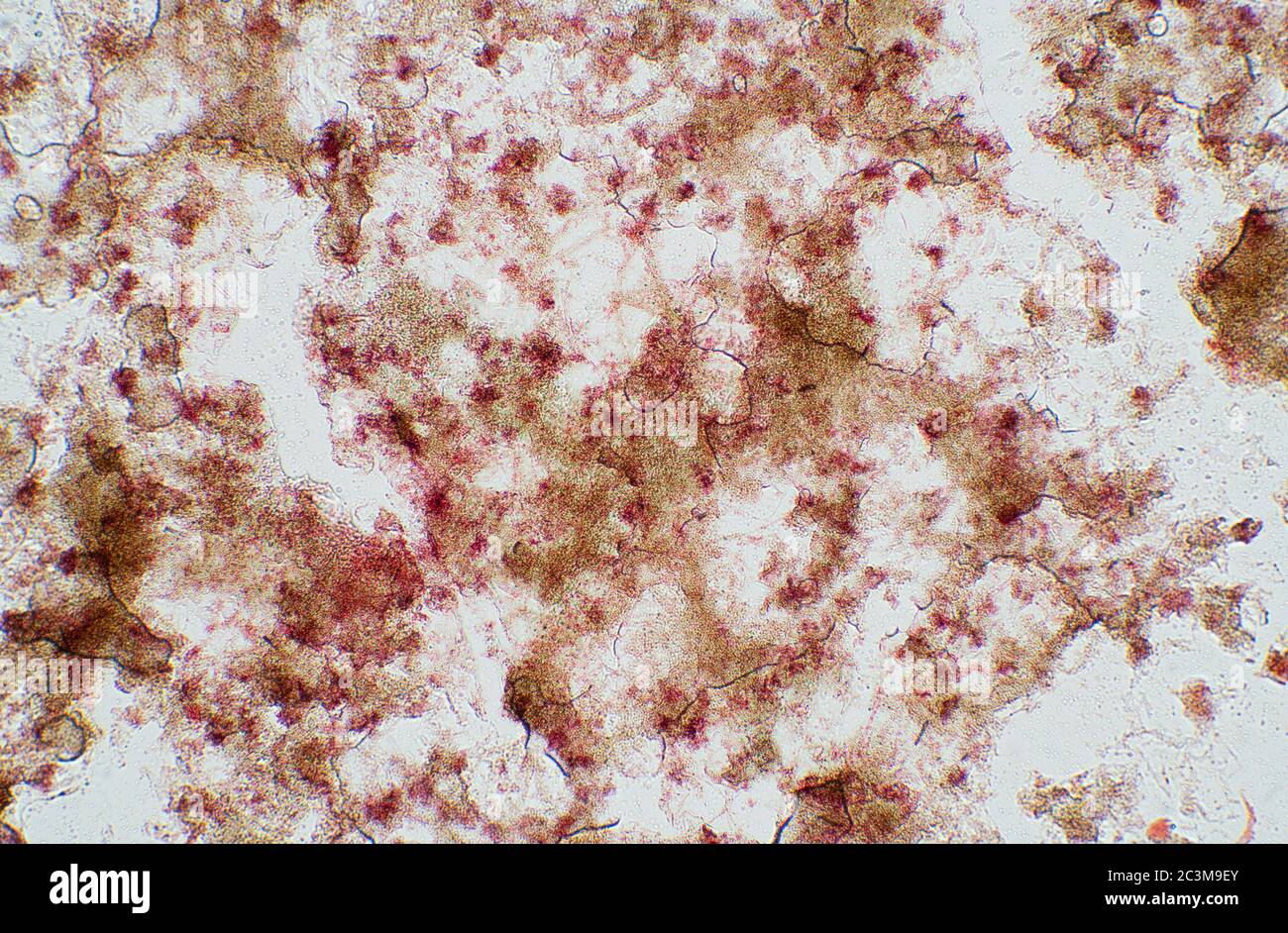 Penicillium fungi Banque de photographies et d’images à haute ...