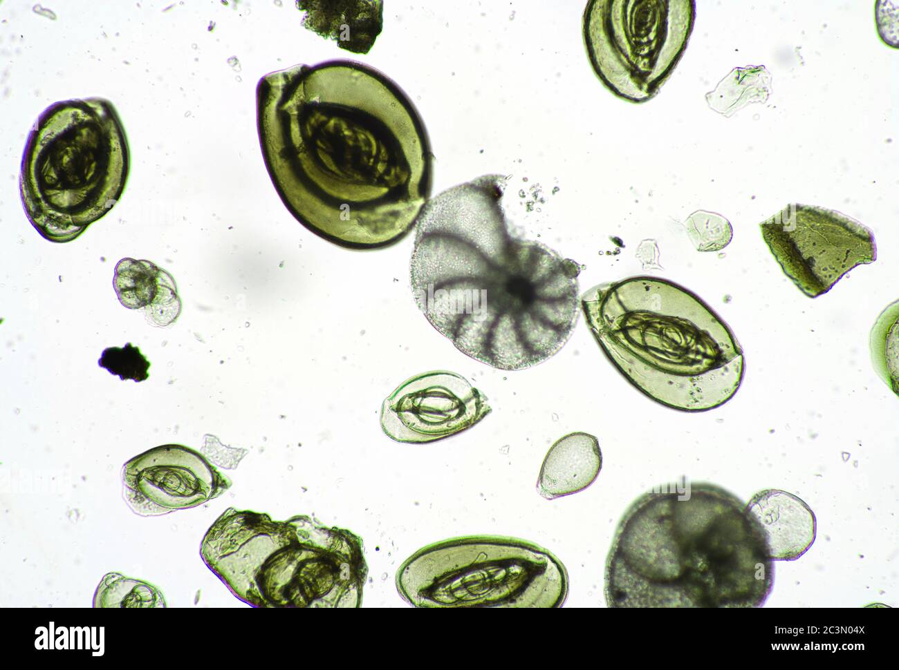Tests de foraminifera, protistes amioboïdes de la mer Adriatique, vue ...