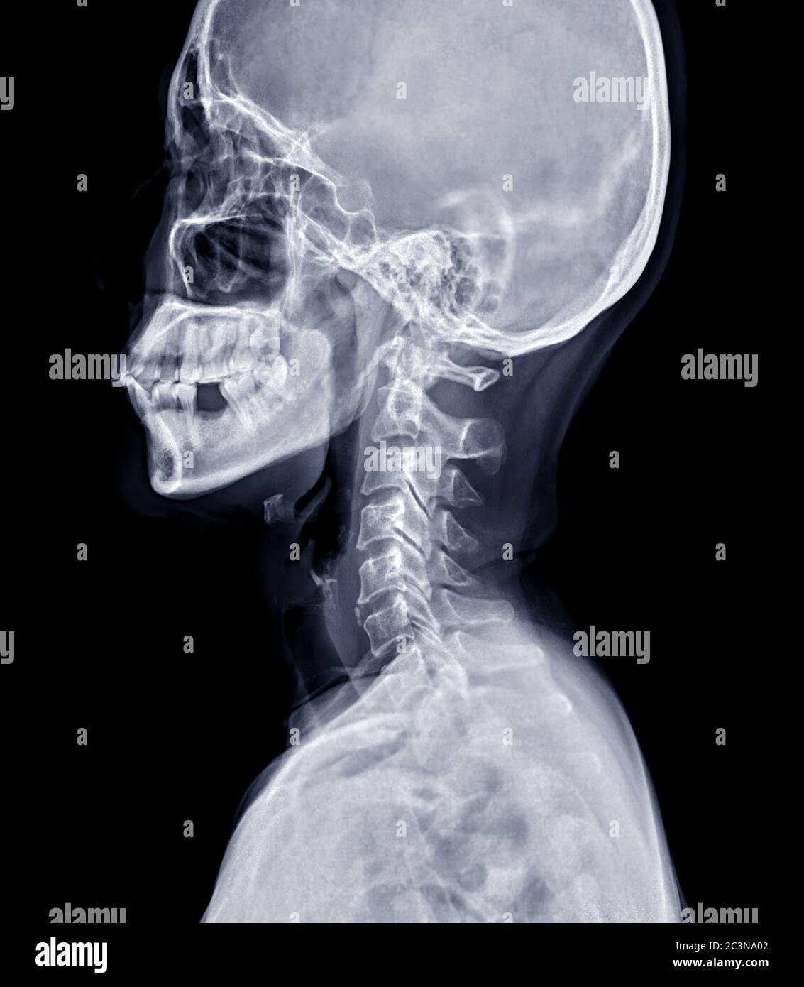 C Douloureux Banque d'image et photos - Alamy