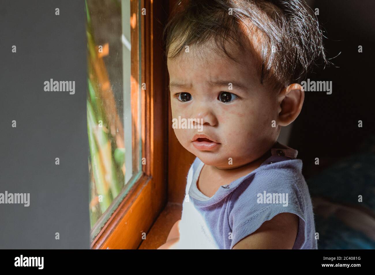 Pityriasis rosea Banque de photographies et d’images à haute résolution ...