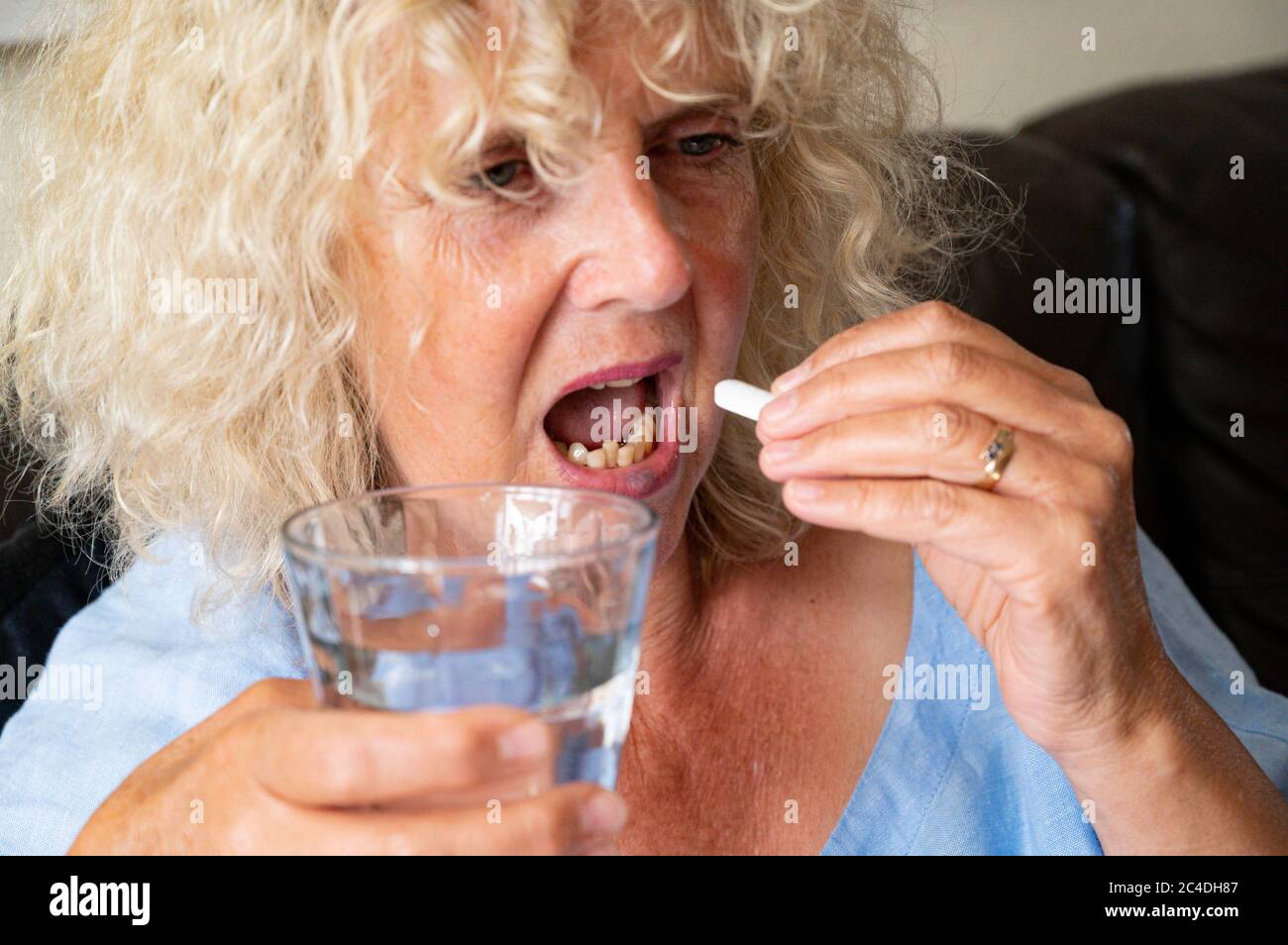 Le zona est causé par le virus varicelle zona Banque de photographies ...