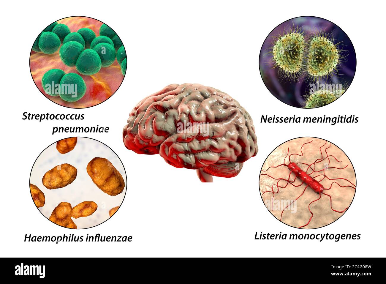 Causes de méningite bactérienne, illustration informatique. Neisseria ...