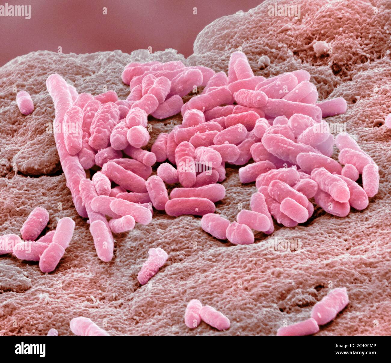 Electron Microscopic Escherichia Coli Banque d'image et photos - Alamy