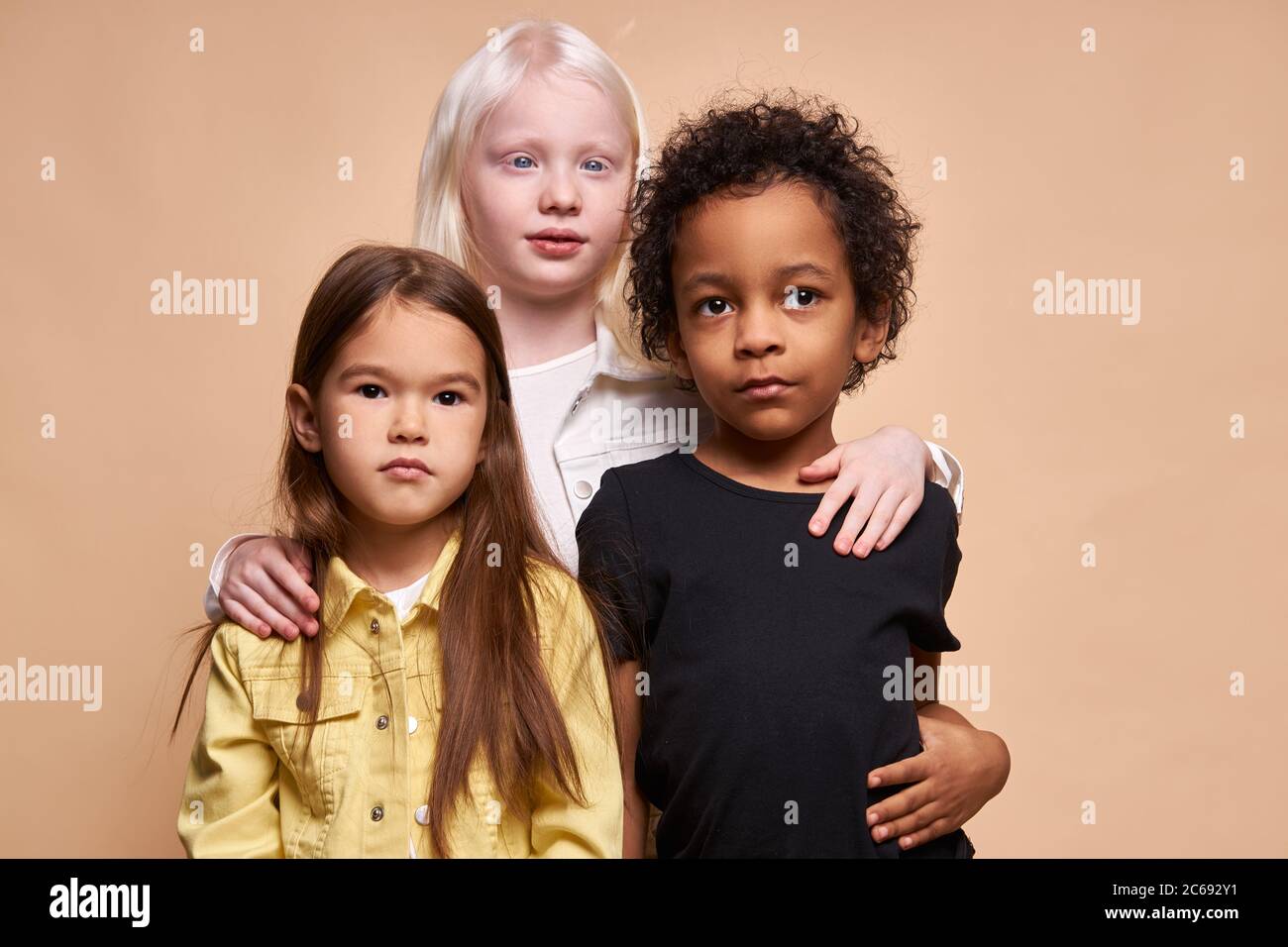 Black children albinos Banque de photographies et d’images à haute ...