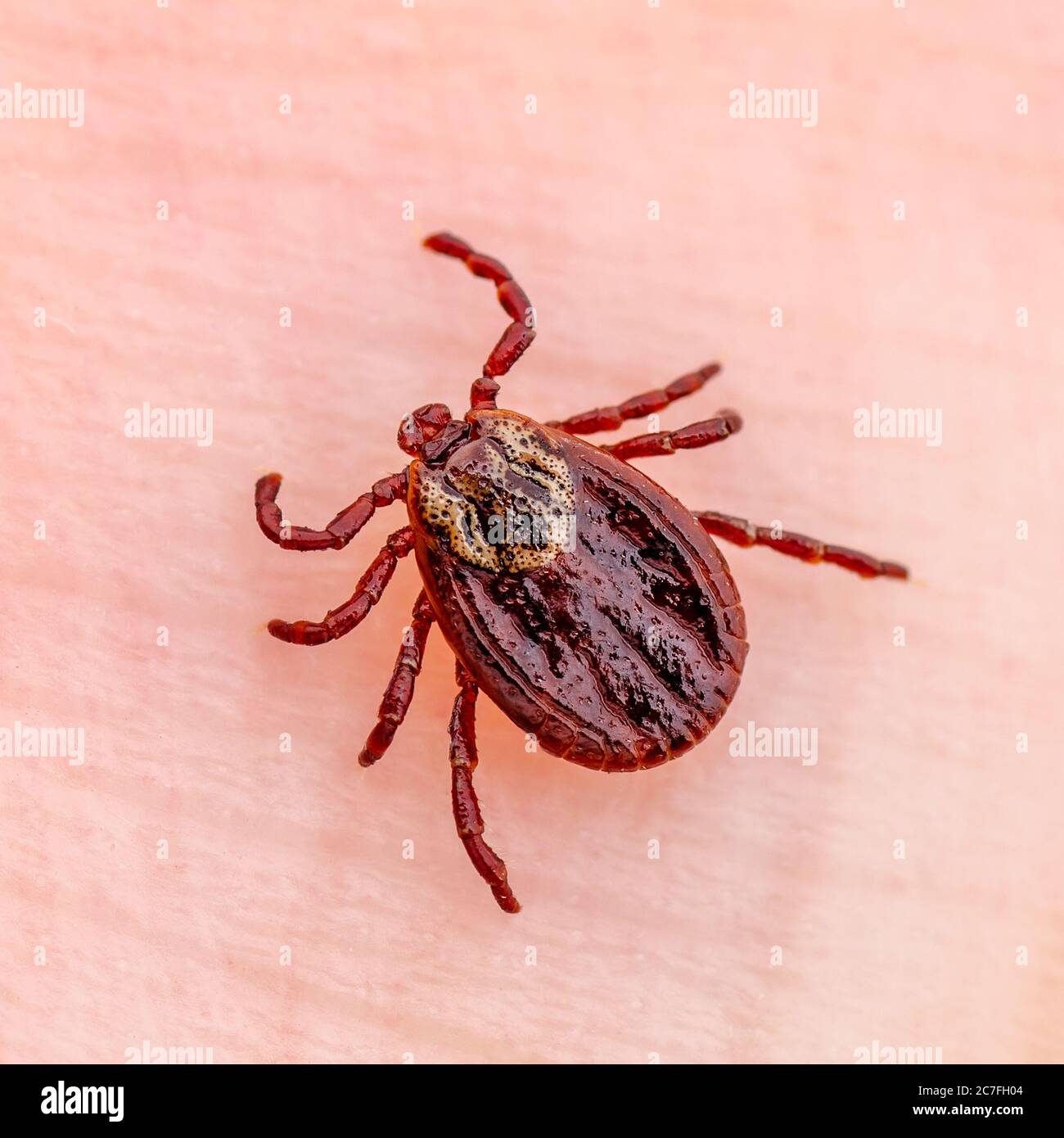 Encéphalite tiques tiques insectes rampant sur la peau. Virus de l ...