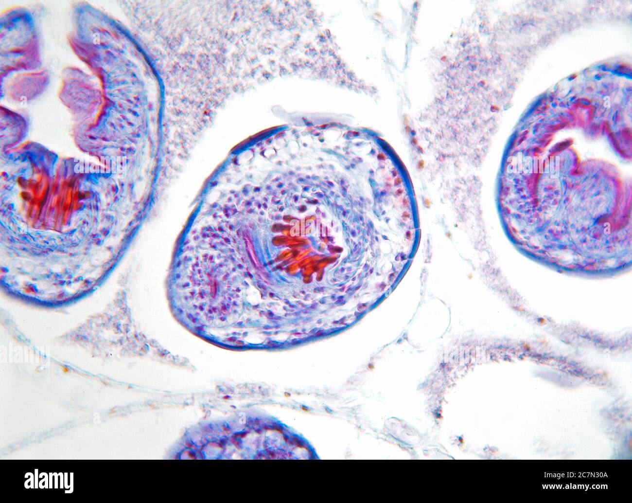 Kystes de l'hydatide ténia du chien en fond clair photomicrographie, TS ...