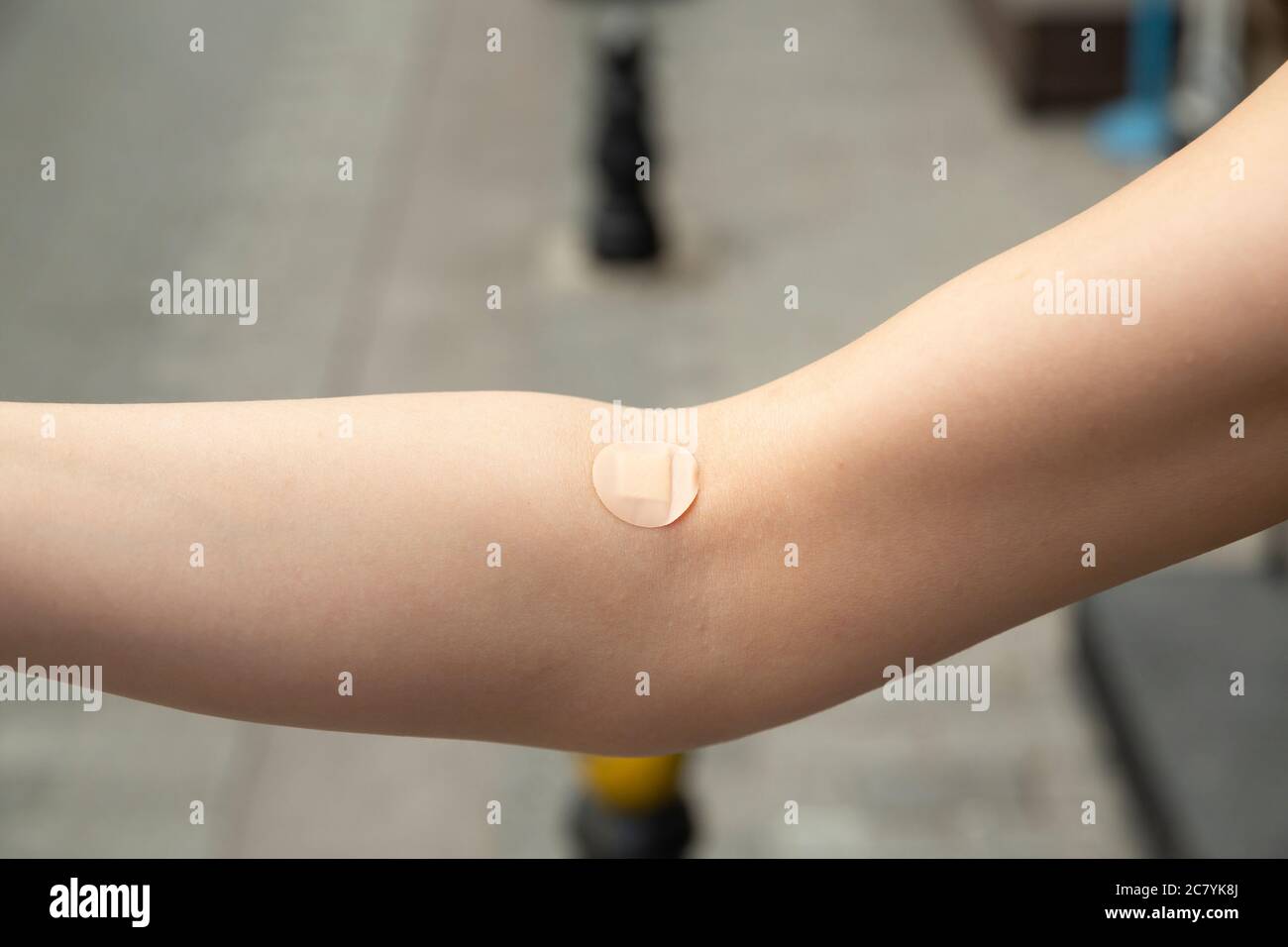 Zona éruption cutanée main Banque de photographies et d’images à haute ...