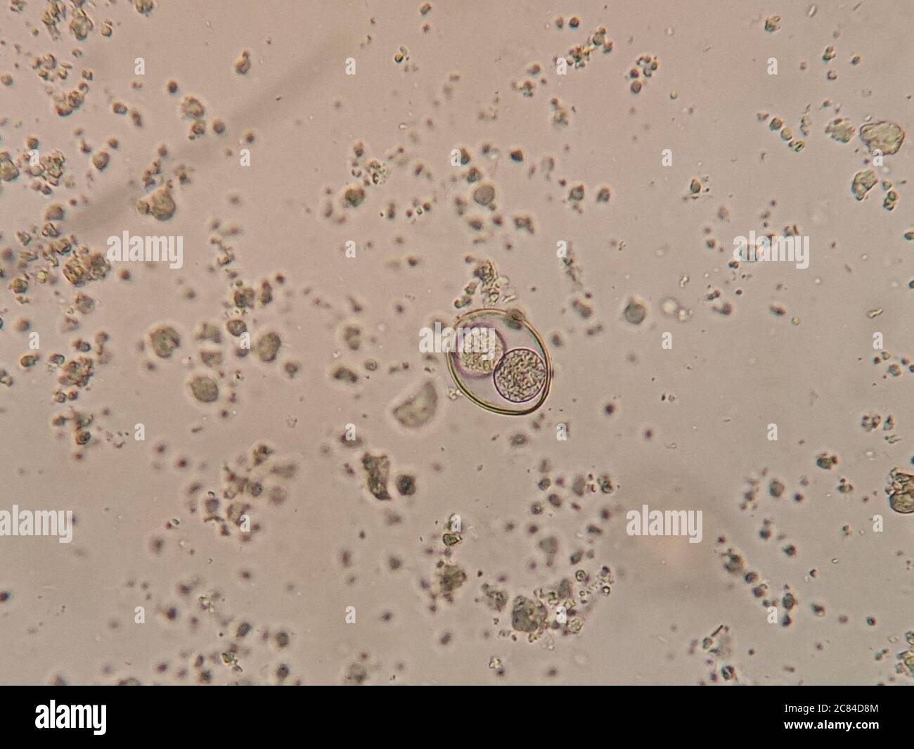 Isospora spp Banque de photographies et d’images à haute résolution - Alamy