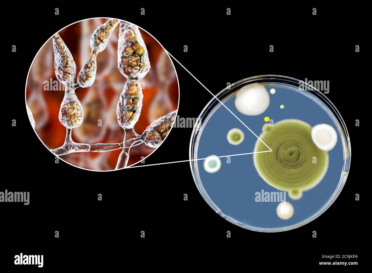 Champignon allergène filamenteux Alternaria alternata, illustration ...
