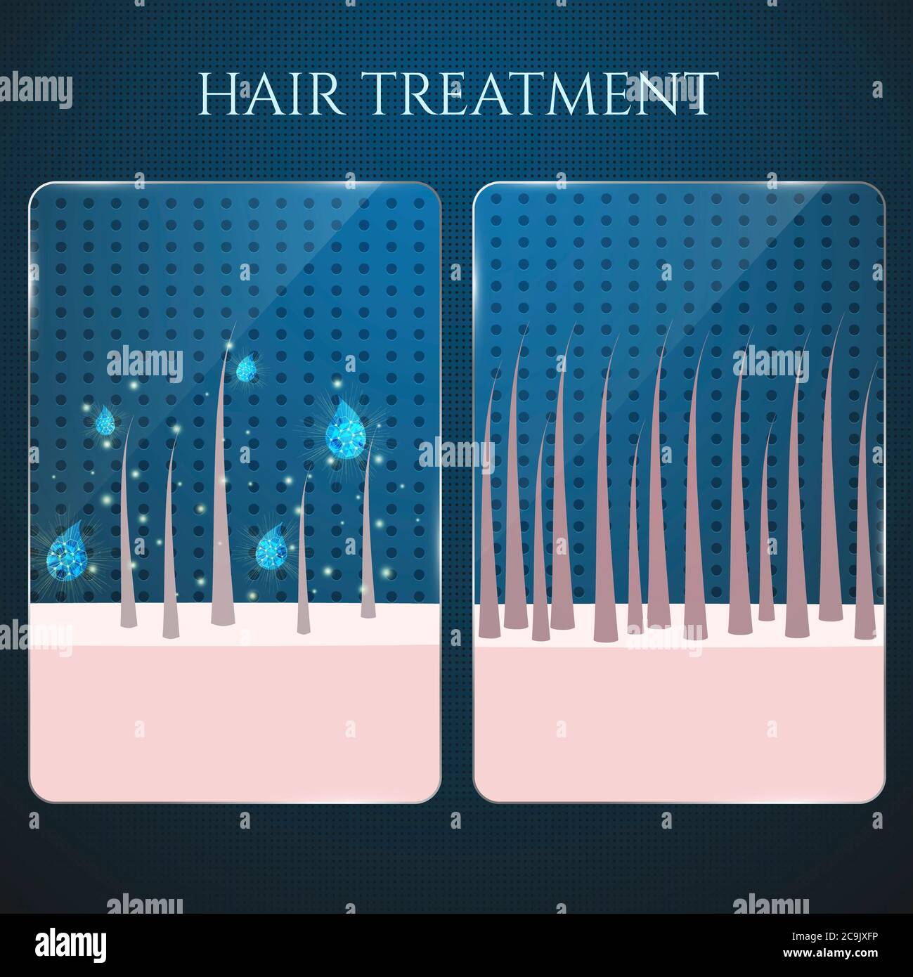 Follicule pileux Banque de photographies et d’images à haute résolution ...