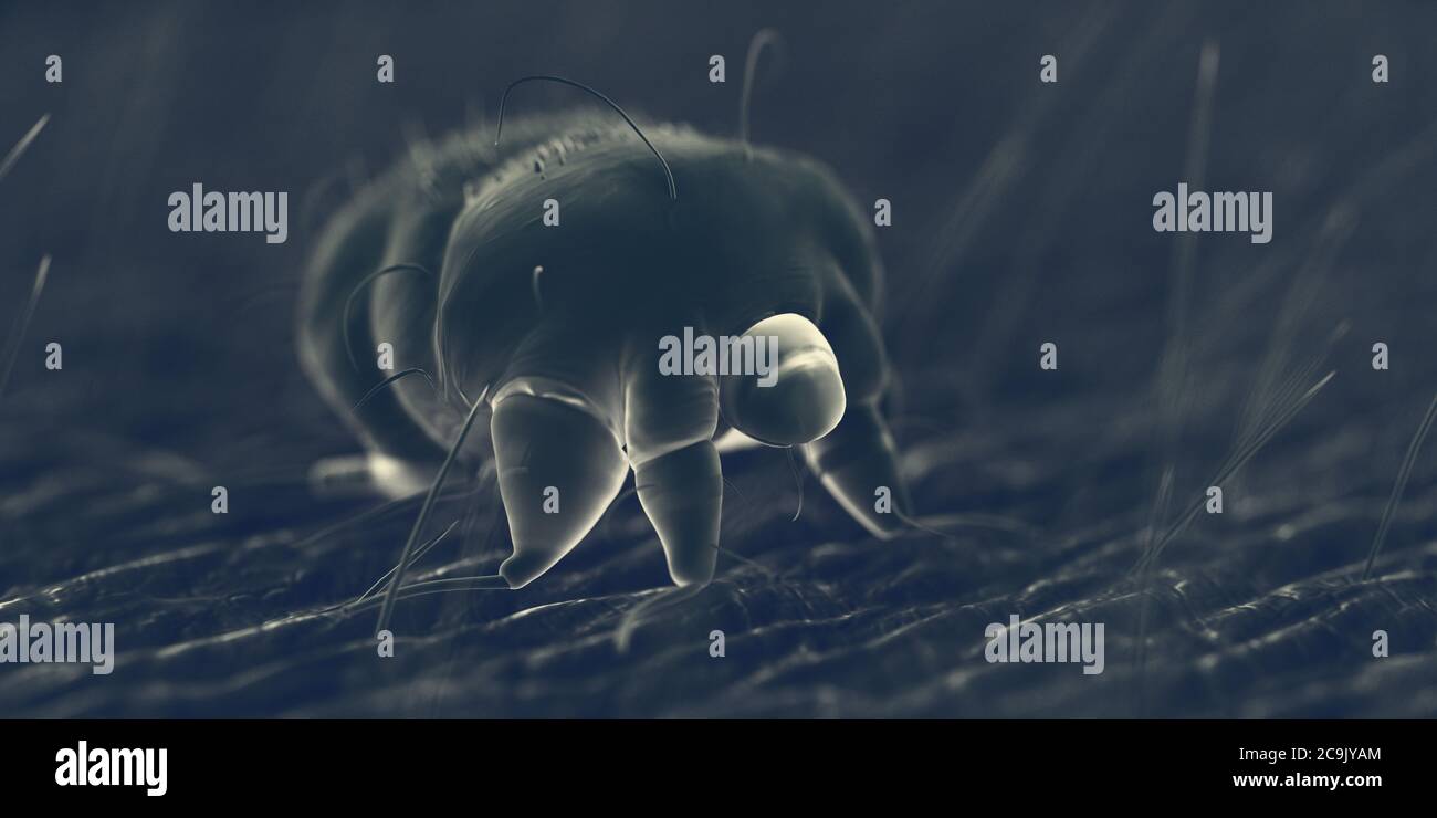 Acarien de la gale sur la peau humaine, illustration informatique Photo ...