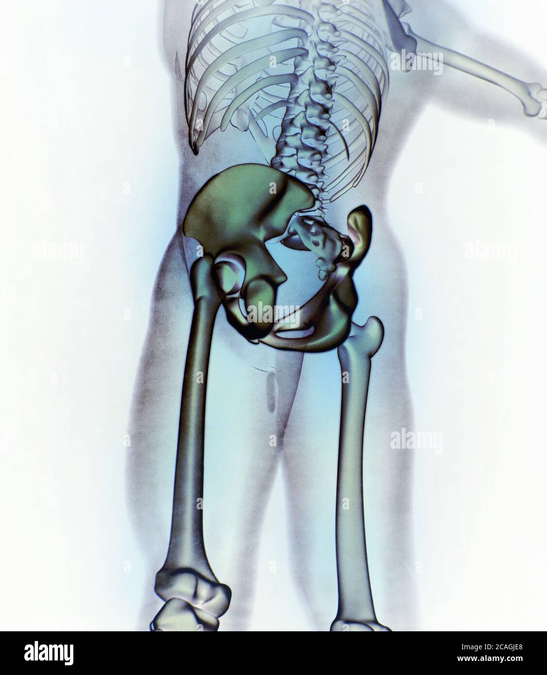 Os d'Illium, os de hanche ou bassin. Anatomie humaine, radiographie de ...