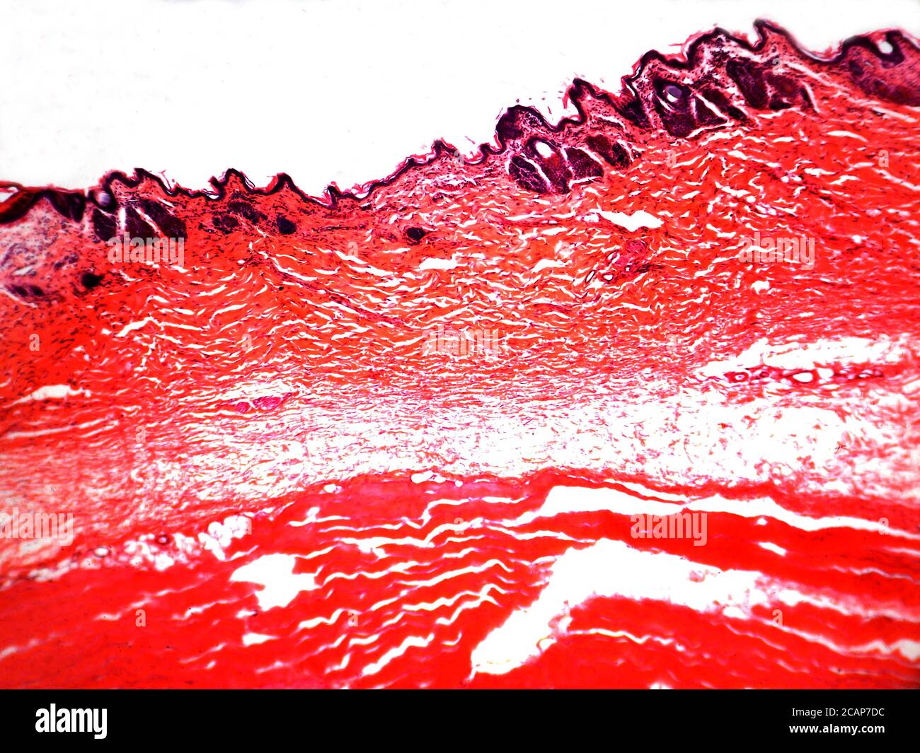 Cellule de peau humaine Banque de photographies et d’images à haute ...