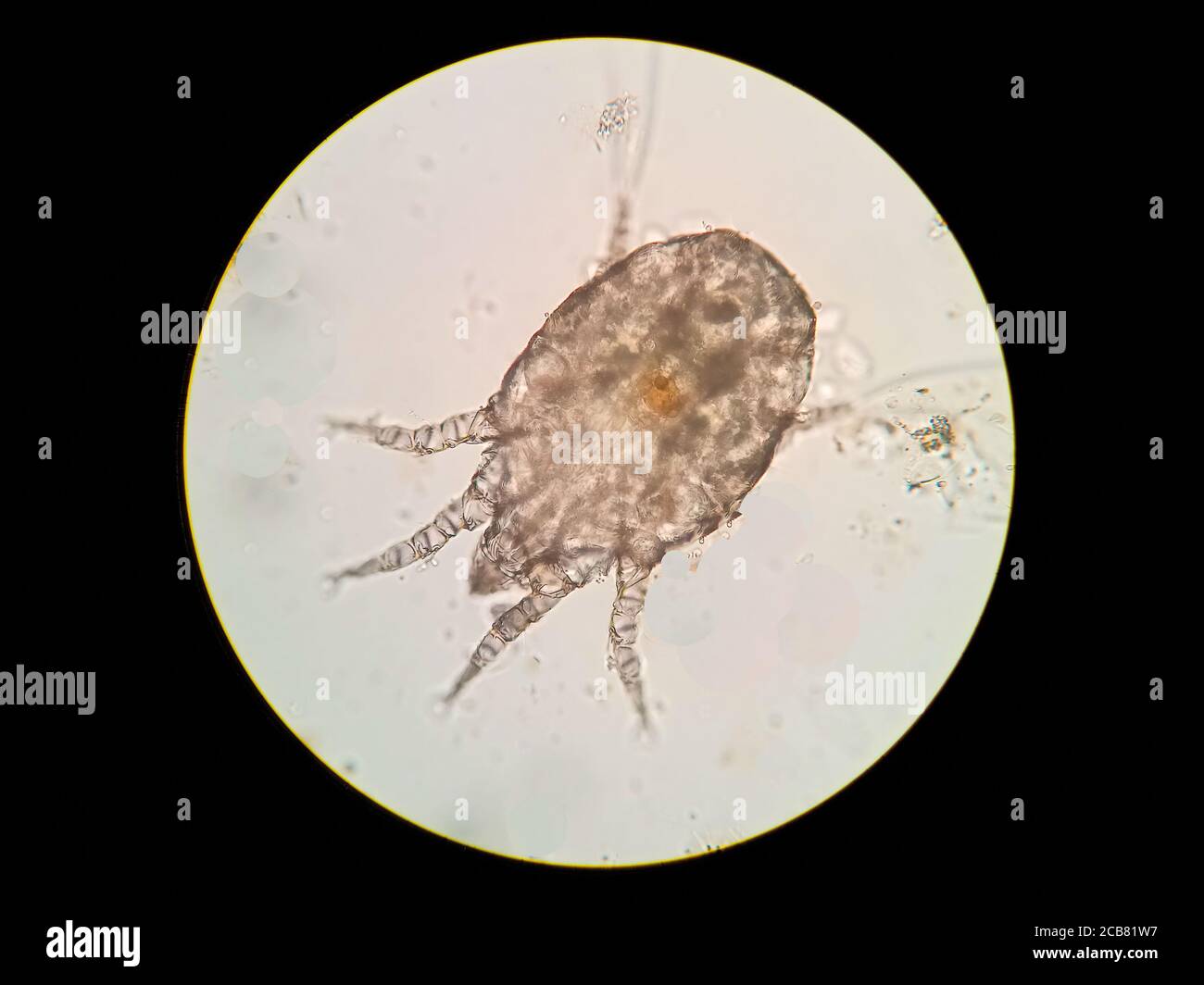 Acariens microscope Banque de photographies et d’images à haute ...