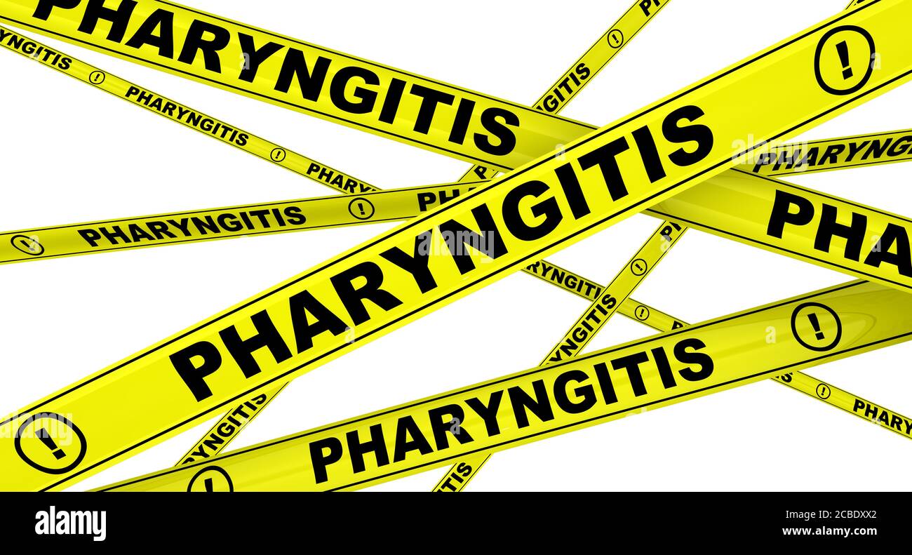 Pharynx inflammation Banque de photographies et d’images à haute ...