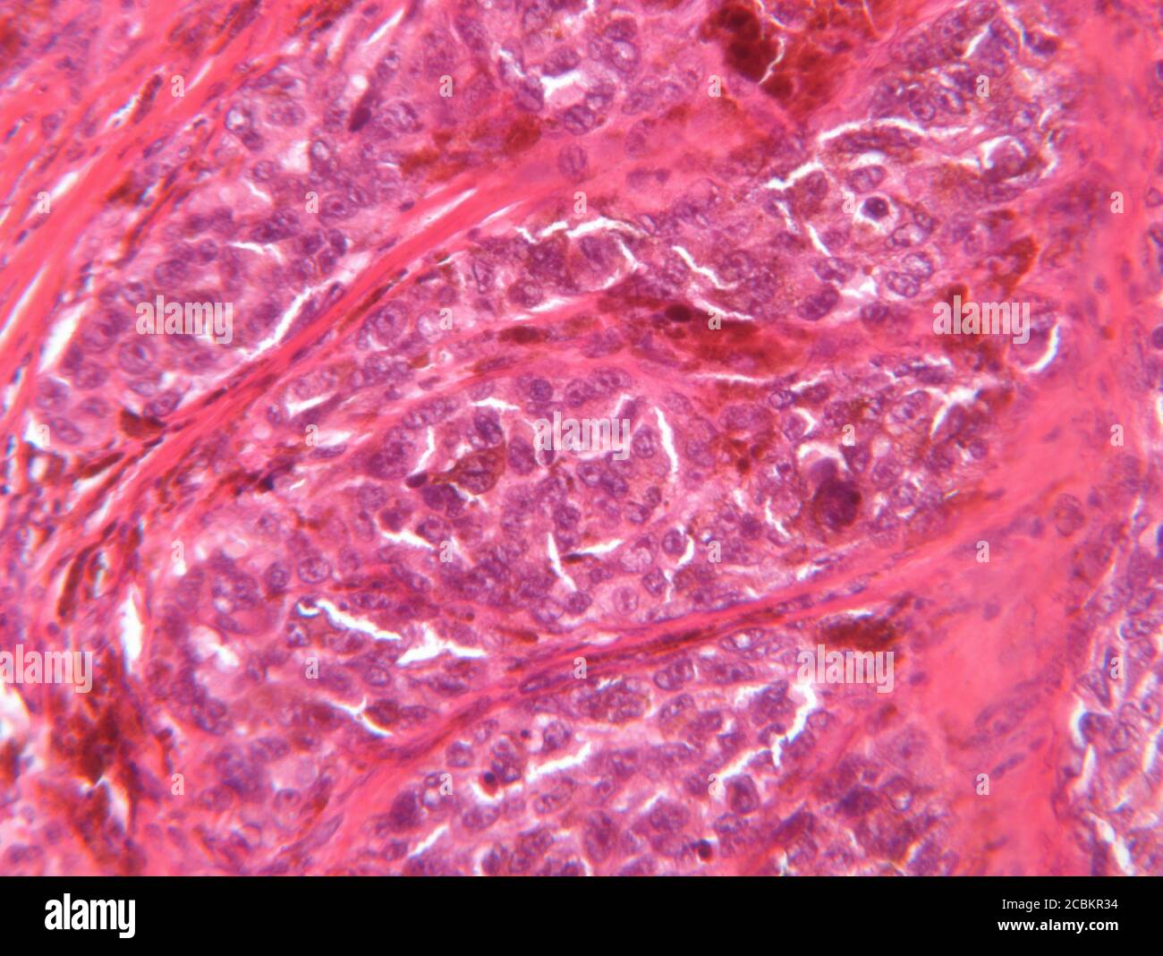 Vue au microscope Banque de photographies et d’images à haute ...