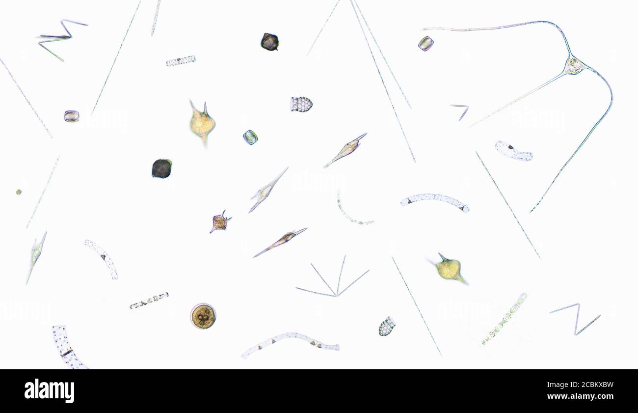 Scanning electron microscopy cell Banque d'images détourées - Alamy