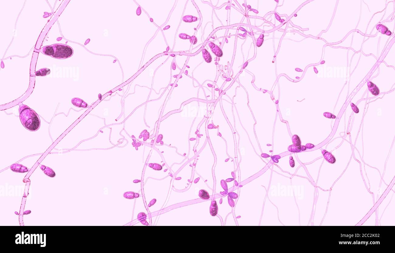 Gros plan de la croissance des dermatophytes champignon causant des ...